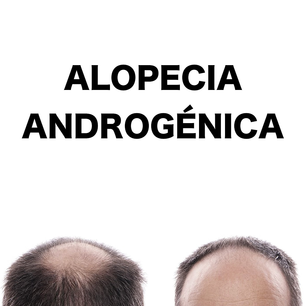 Alopecia Androgénica: Guía DEFINITIVA 2025 para Combatir la Calvicie y ...